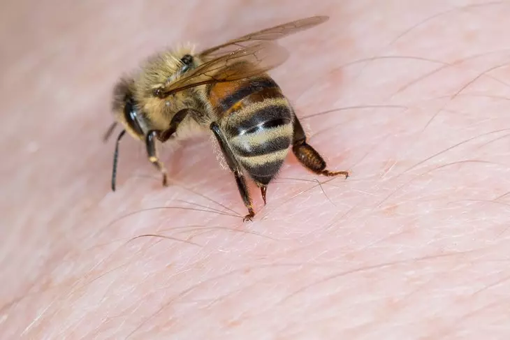 Bee sting